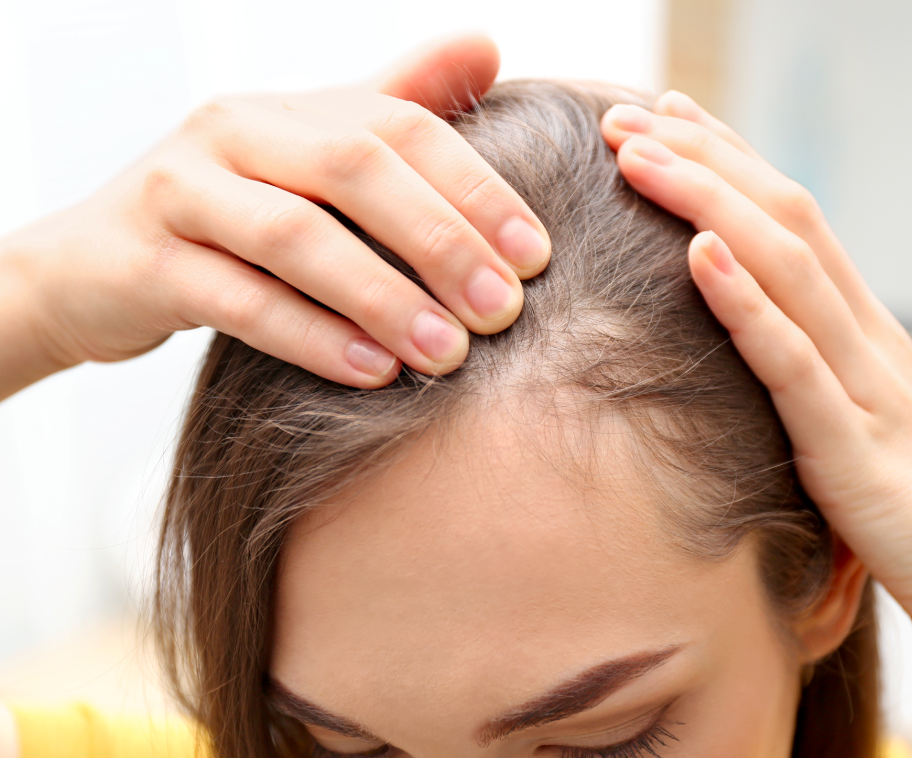 How to Treat Hairloss – Doctor Rogers Skin Care