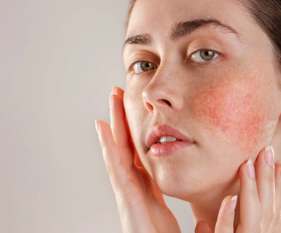 How to Calm Irritated Skin – Doctor Rogers Skin Care