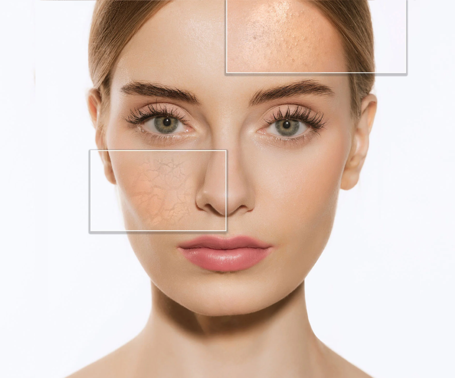 What is combination skin? How can you tell if you have it? – Doctor ...